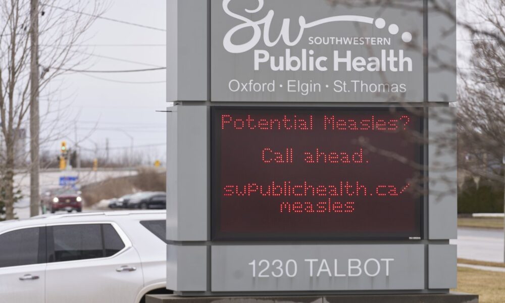 Warning issued as measles circulates in northeast B.C. community - The ...